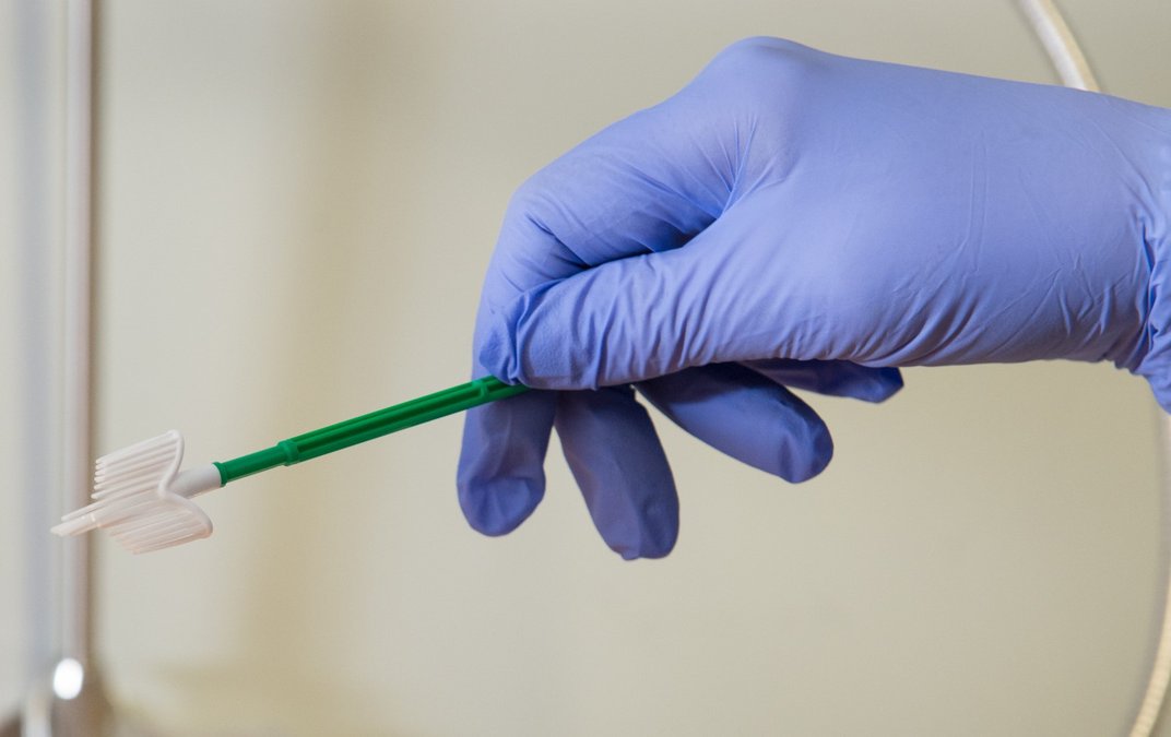 Screening for cervical cancer – why the number of years between ...