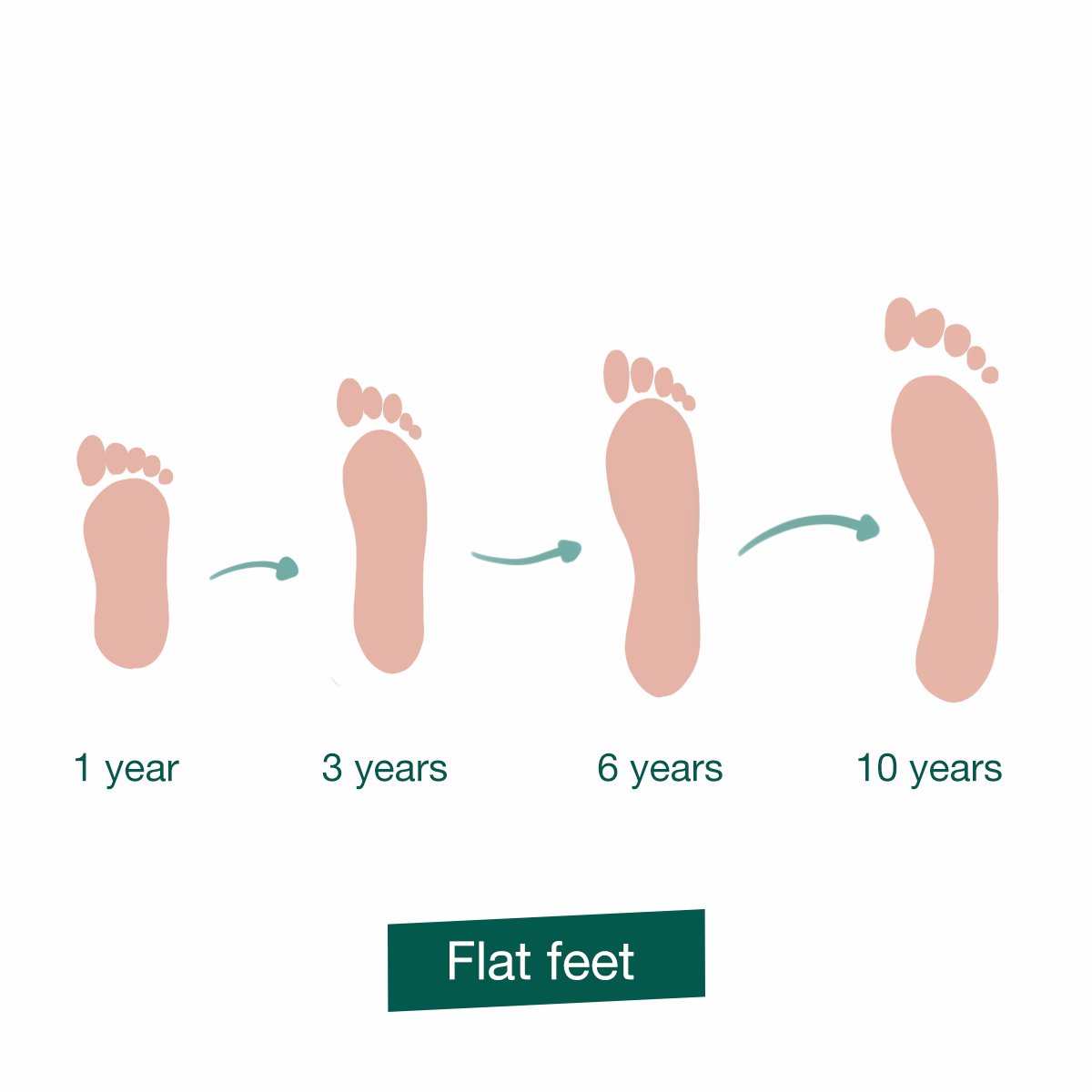 Flat feet in children - HSE.ie
