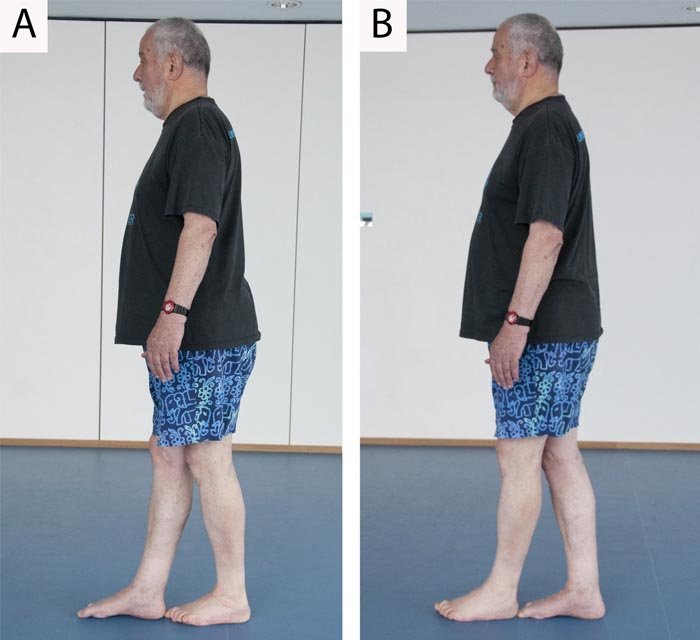Balance exercises - HSE.ie
