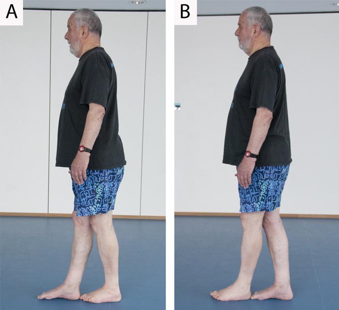 Balance exercises - HSE.ie