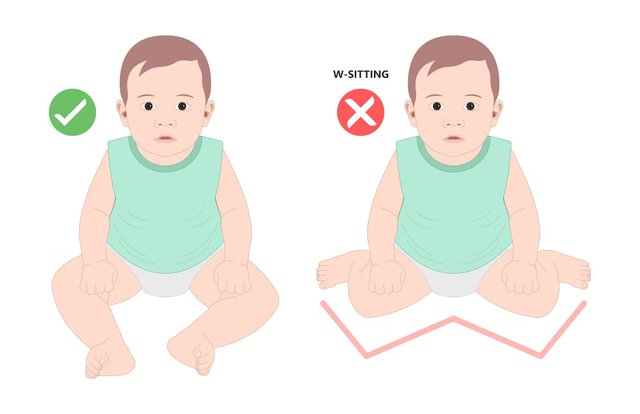 In-toeing and out-toeing - HSE.ie