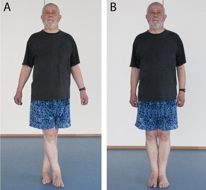 Balance exercises - HSE.ie